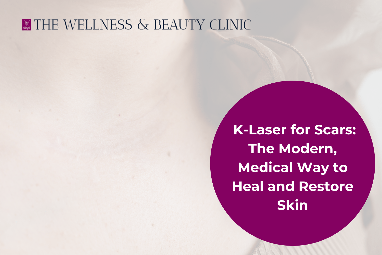 K-Laser for Scars: Heal & Restore Skin with Blue Laser